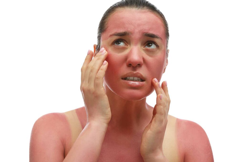 5 Most Common Summer Injuries - RapidCare Emergency Room