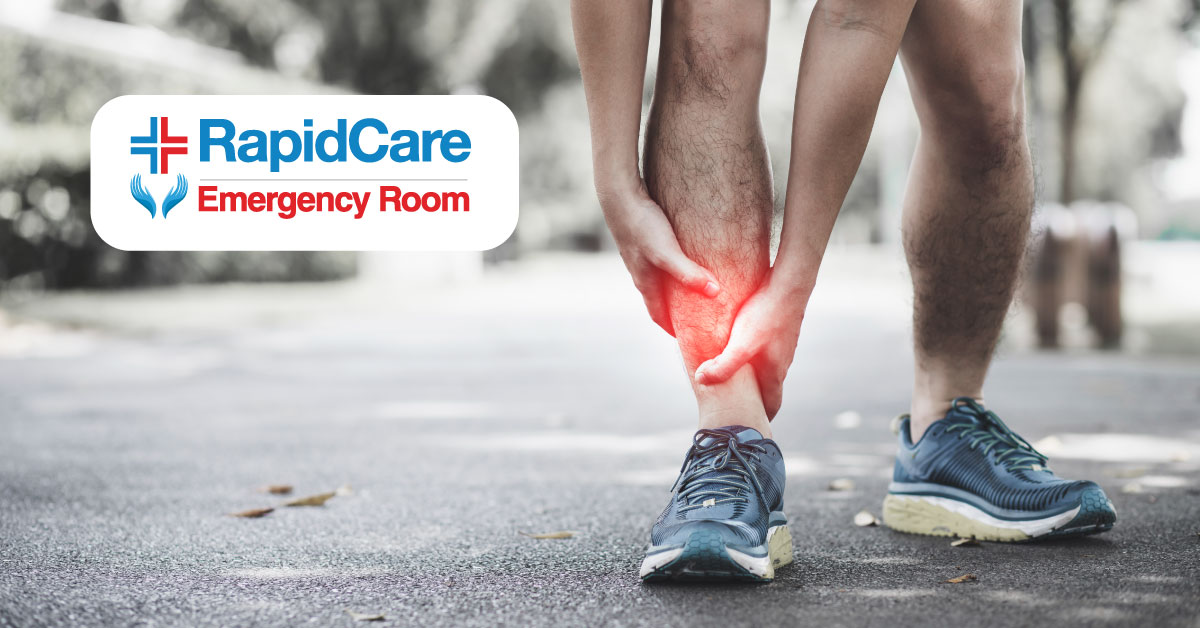 Broken Bones and Sprains ER or Urgent Care - RapidCare ER