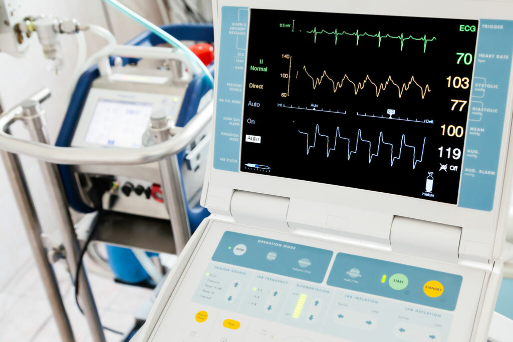 EKG - RapidCare Emergency Room