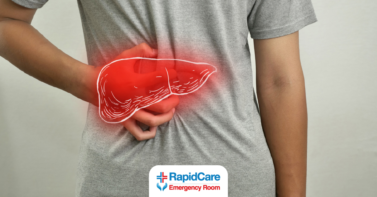 Prevent Liver Emergencies - RapidCare Emergency Room Fast 24/
